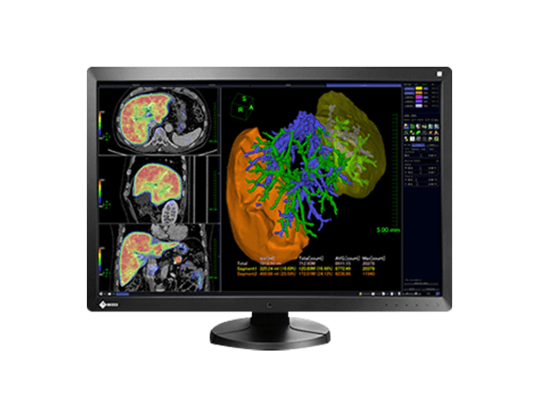 RadiForce RX650 - Trucell