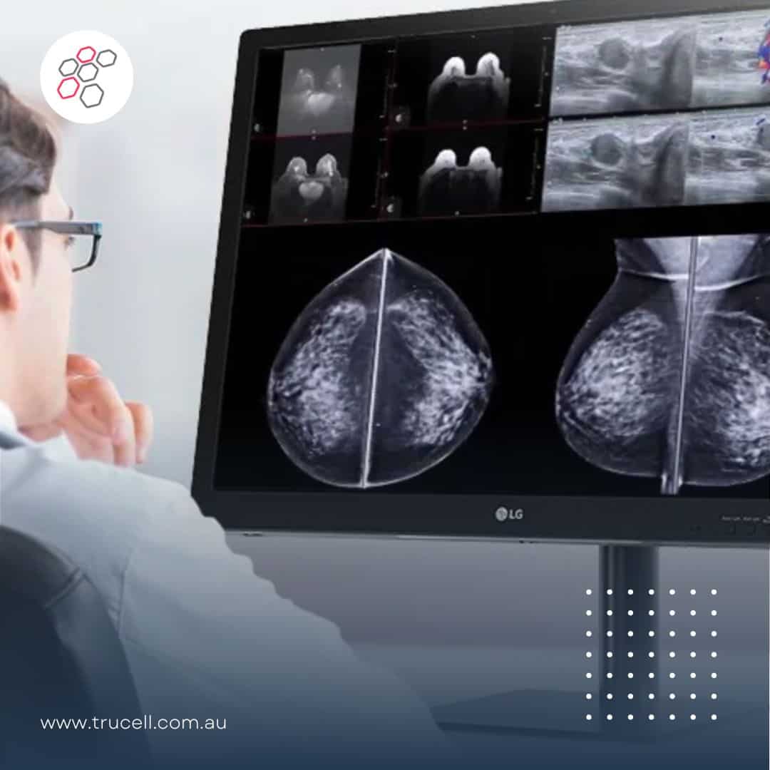DICOM Compliance Test and Displays: Monitoring the Monitors