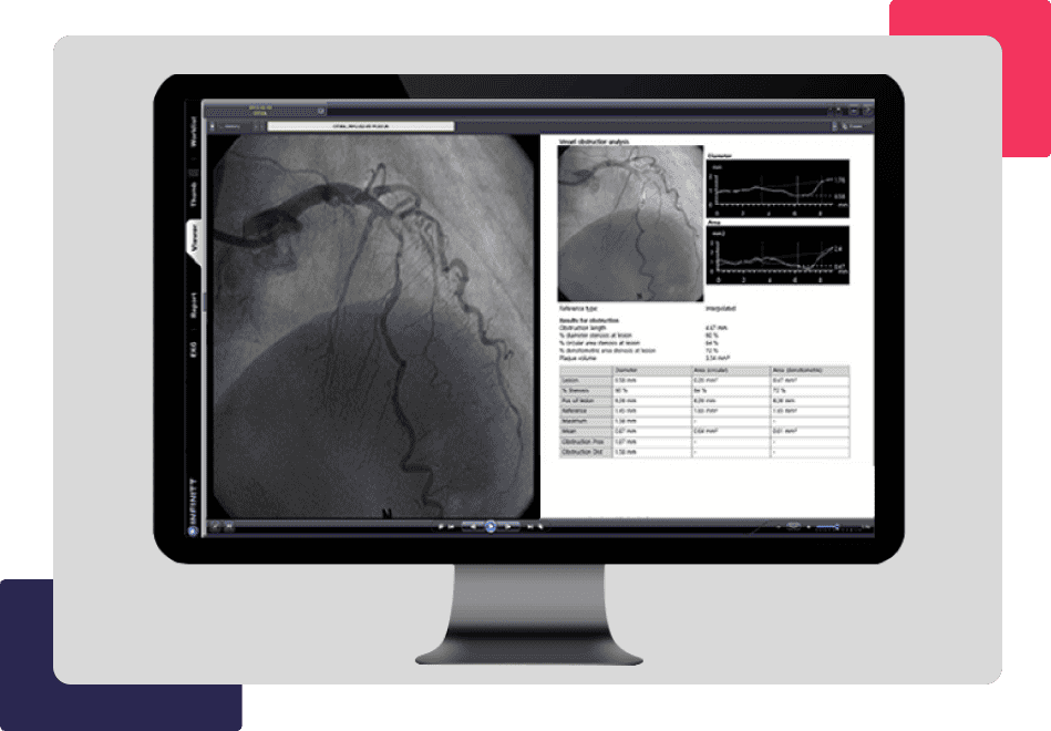 INFINITT PACS - Web Based Image Management