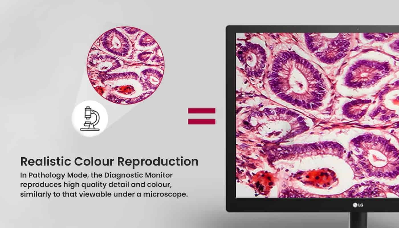 Medical Display Monitor Benefits | Trucell